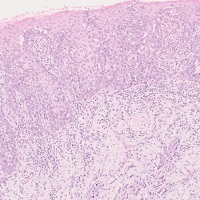 病理標本：女性生殖器1|新潟大学医学部臨床病理学分野